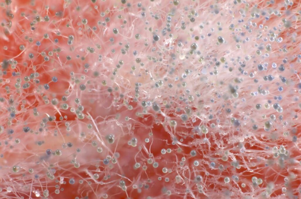 Strawberry Plant Diseases: Bacteria, Fungi, Molds & Viruses